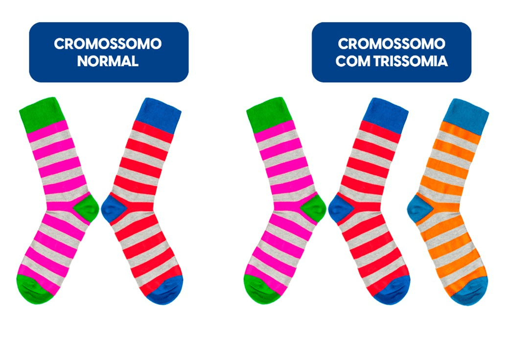 Síndrome de Down: 10 coisas que você precisa saber!